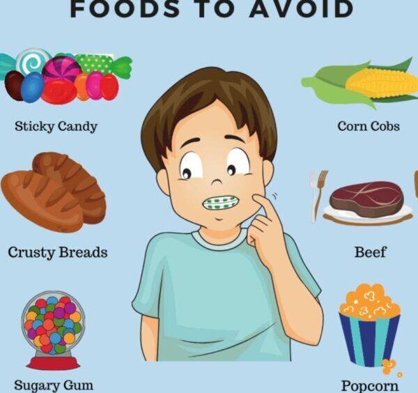 Eten met een Beugel: ONTDEK het Beste VOEDINGSADVIES!