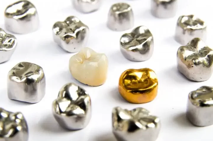 Evolutie van ESTHETISCHE KRONEN: VAN TRADITIONEEL naar MODERN